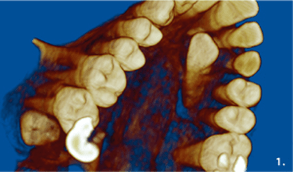 DOLPHIN IMAGING - 株式会社ジーシーオルソリー
