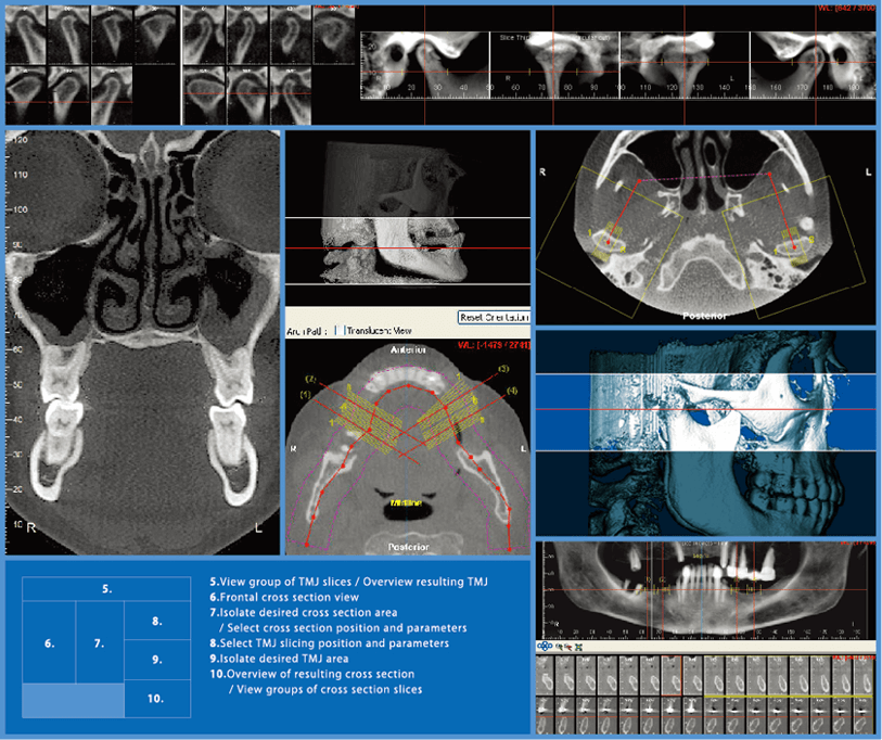 DOLPHIN IMAGING - 株式会社ジーシーオルソリー
